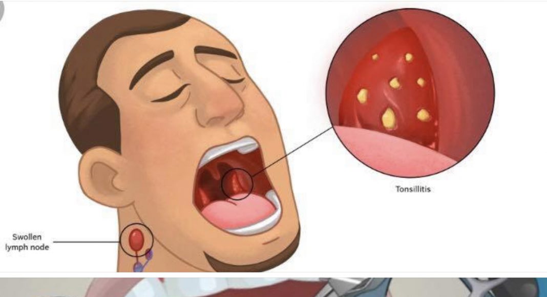 Slipped Disc, Kenali Punca Dan Cara Cegah Sebelum Terlambat - Keluarga Slipped Disc, Kenali Punca Dan Cara Cegah Sebelum Terlambat - Keluarga