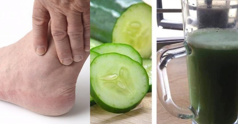 Khasiat Beetroot Ramai Jarang Dengar - Dr Rizal