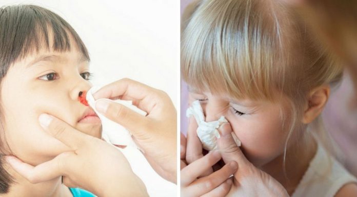 Anak Asyik Hidung Berdarah Bukan Petanda Penyakit Serius. Dr Ini ...
